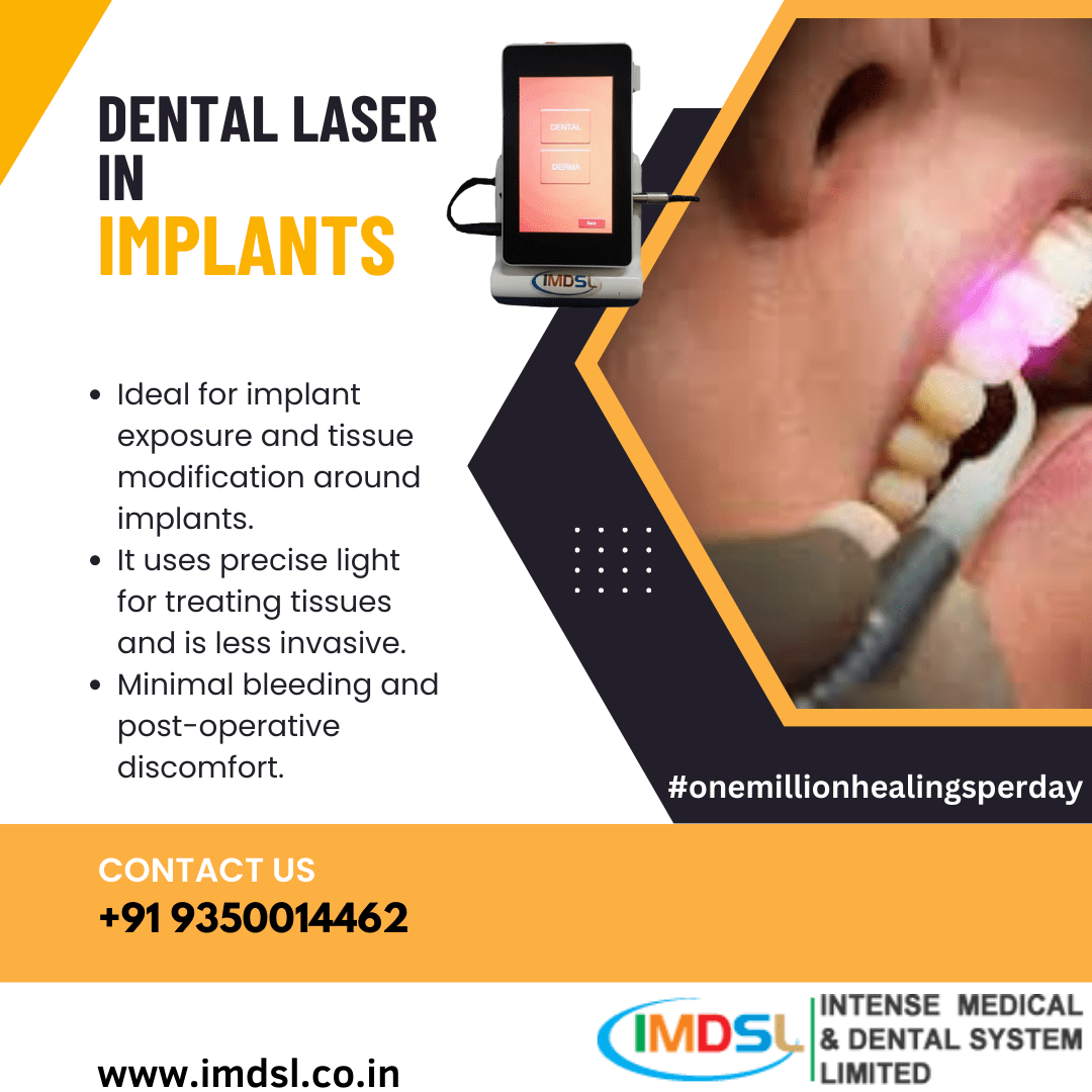 Using Dental Laser for Dental Implants