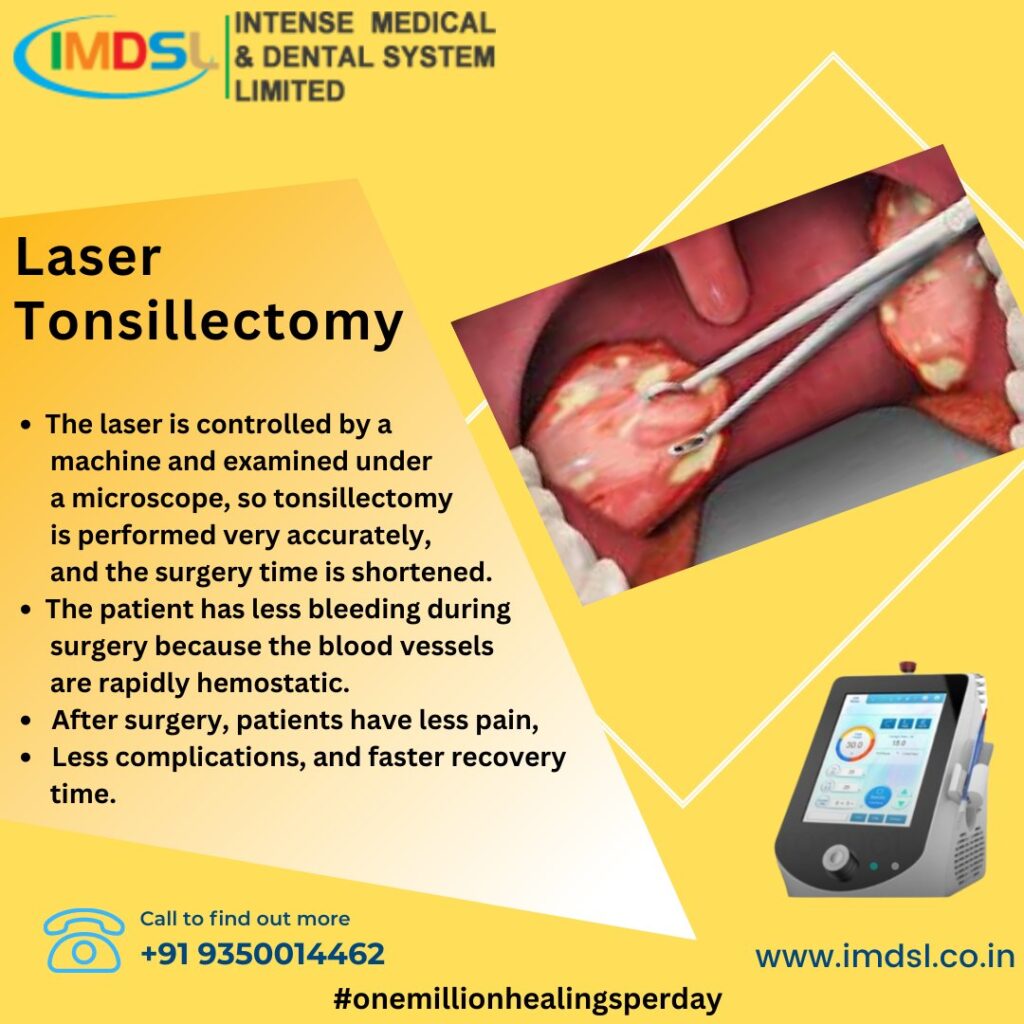 Discovering the Advantages of Laser Tonsillectomy